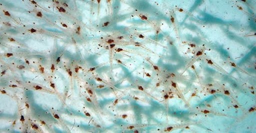 How to choose the best post-larvae? - Shrimps